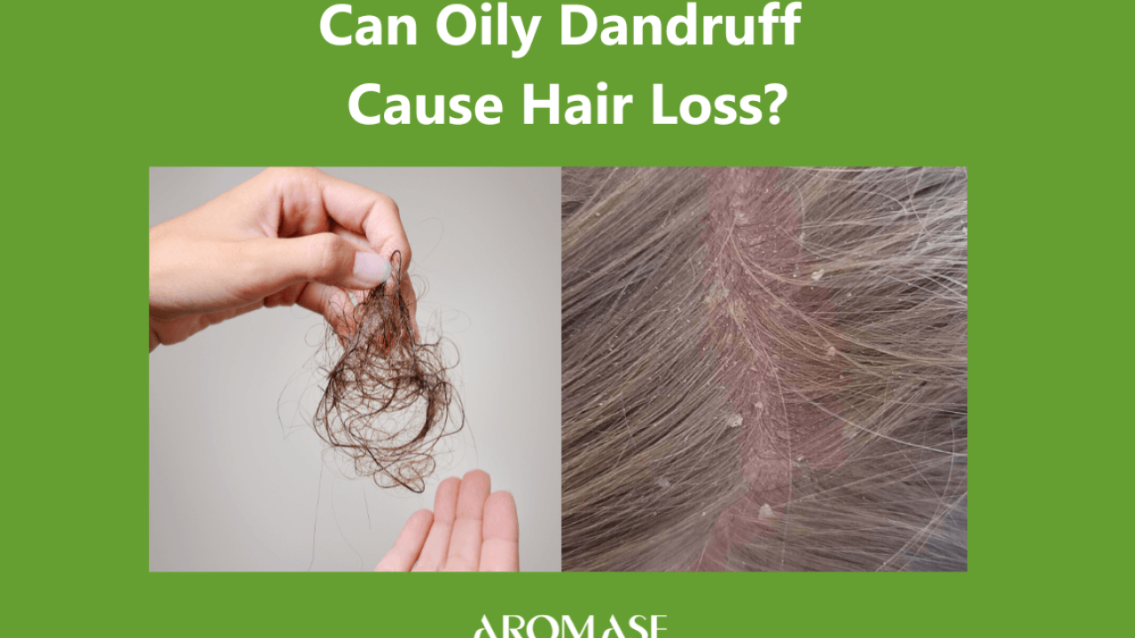 Oily scalp hair loss store